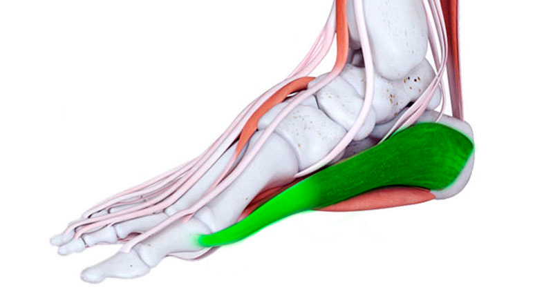 Ból stopy - Jak sobie pomóc, gdy to odwodziciel palucha?