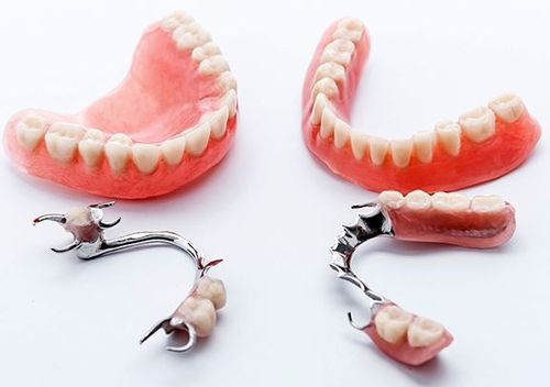 Dentures: Get The Best Dentures from Anderson Dental Professionals ...