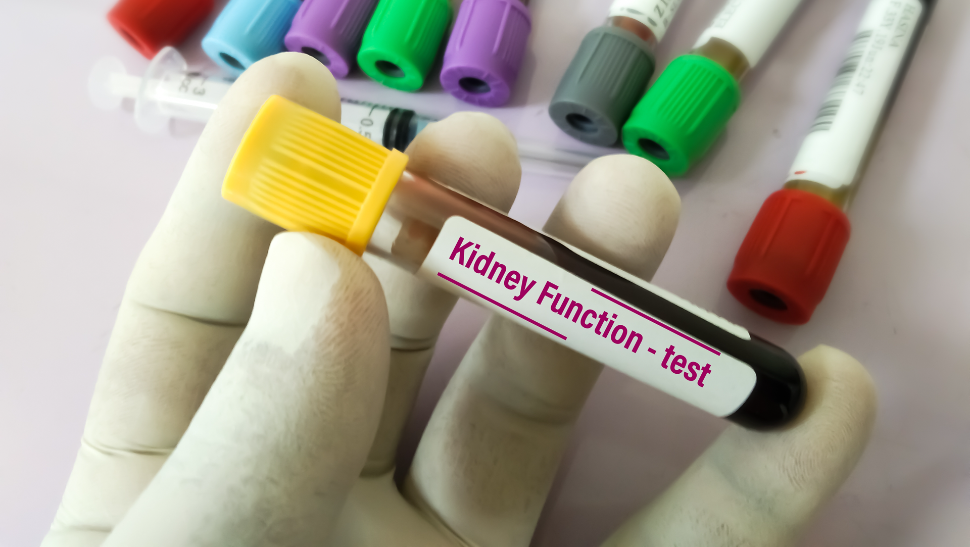 Stanford Study Advocates for Widespread Early Screening of Chronic ...