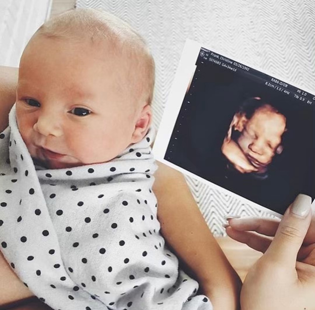 Ultrasound Gallery - Baby Ultrasound Bowmanville + Hamilton | Love At ...