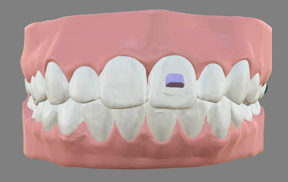 Movimientos dentarios | FuturaLabs