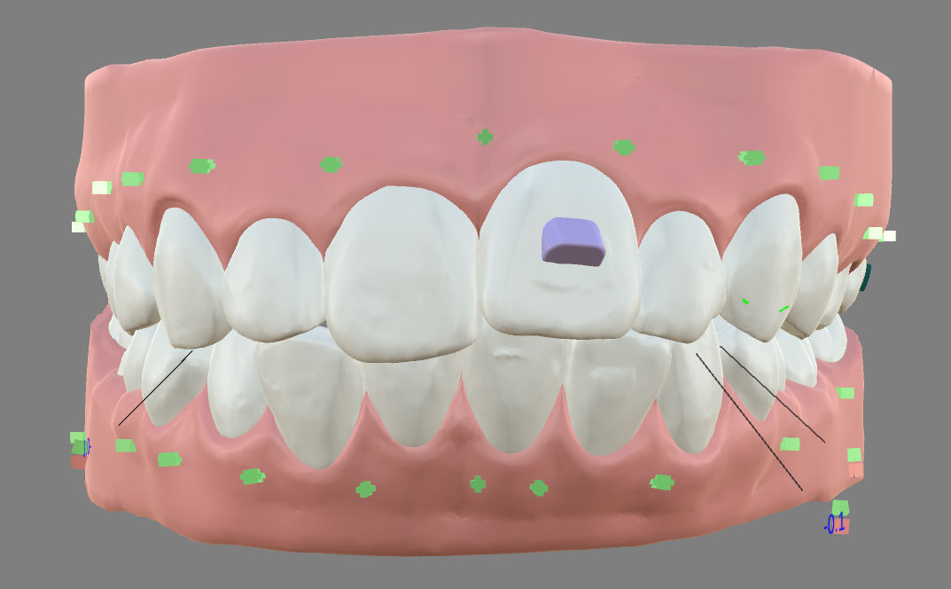 Movimientos dentarios | FuturaLabs