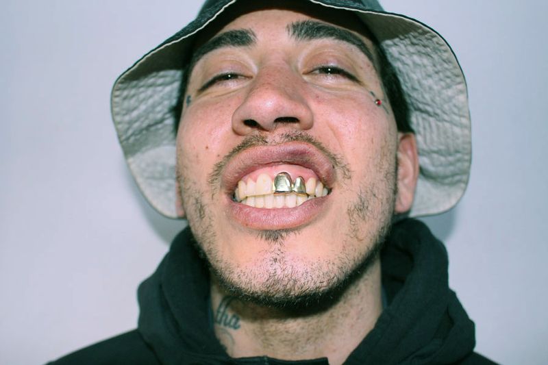 Pearl Set Studio - Grillz