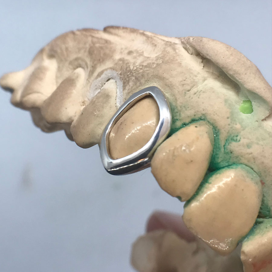 Single Window Grill/s | Pearl Set Studio - Grillz