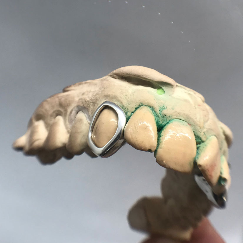 Single Window Grill/s | Pearl Set Studio - Grillz