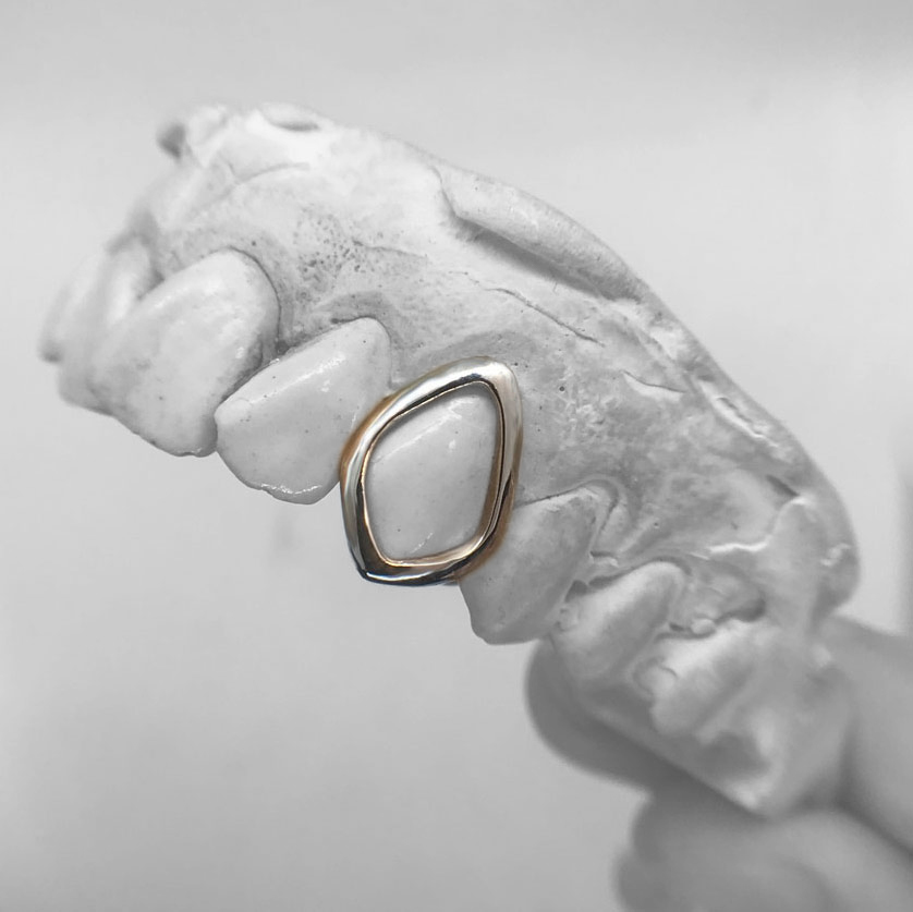 Single window grill | Pearl Set Studio - Grillz