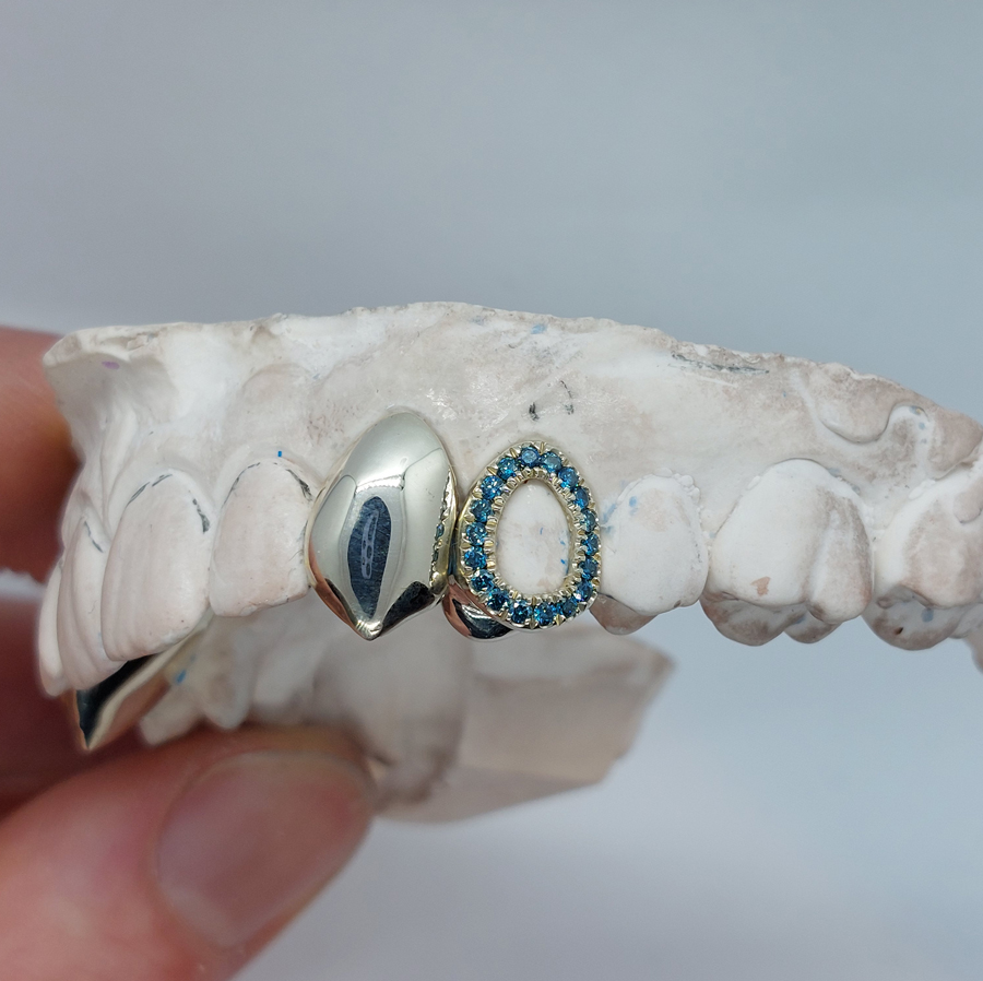 Diamond Stone Set Window and Full Cap | Pearl Set Studio - Grillz