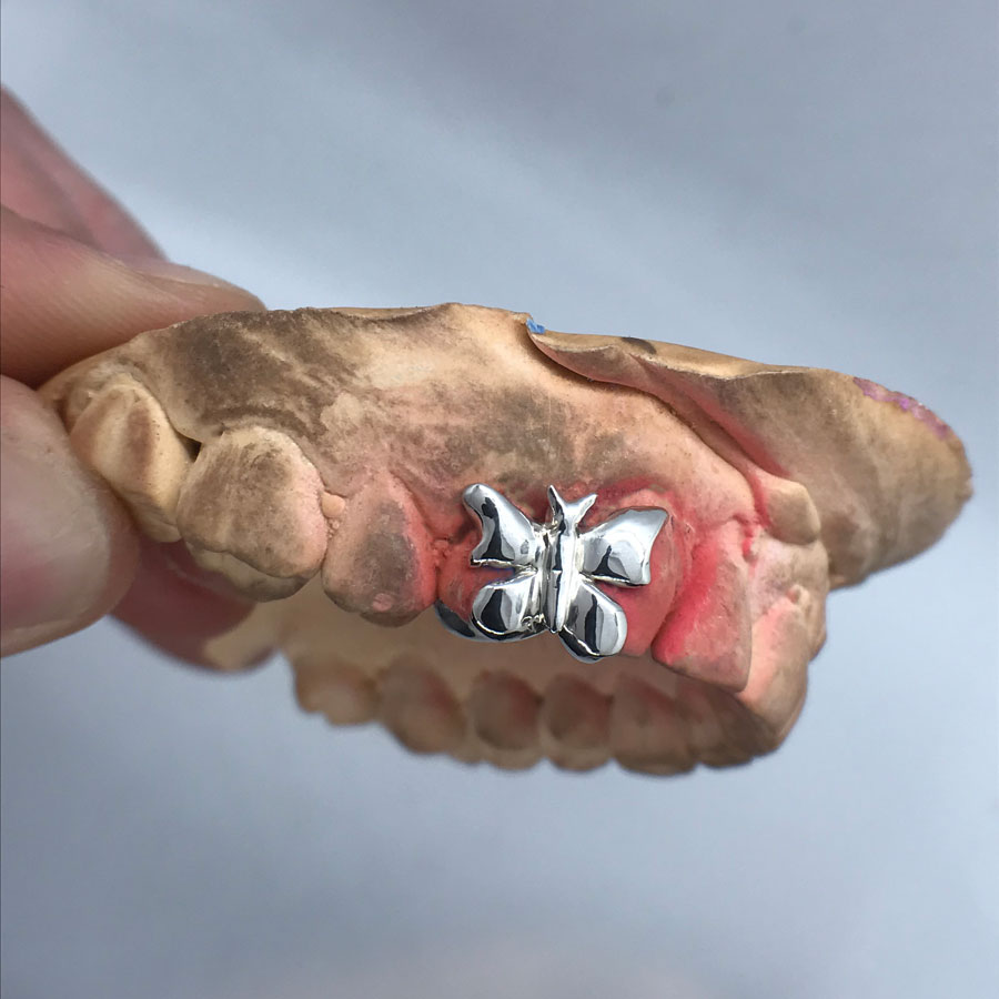 Butterfly grill | Pearl Set Studio - Grillz