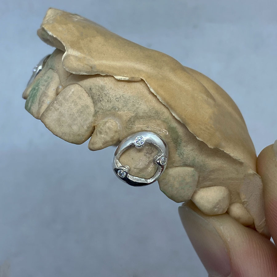 Stone Window Inlay | Pearl Set Studio - Grillz