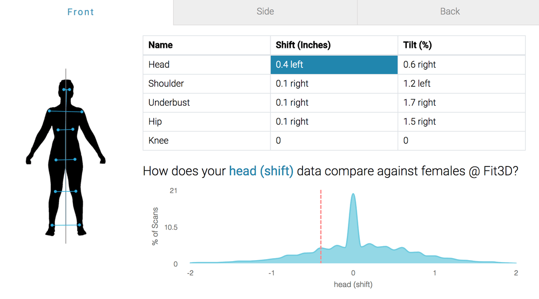 Posture Assessment Technology for Chiropractors. Non-Invasive 3D Body ...