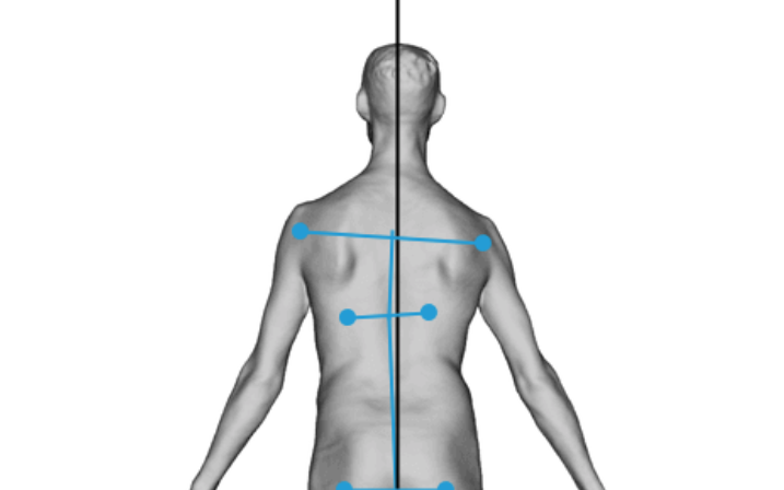 3d body scans for chiropractors