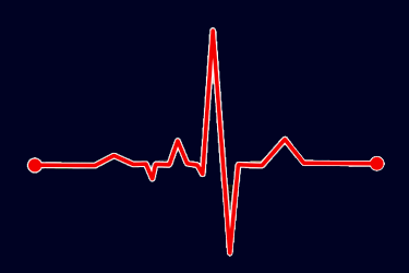 Pulse For Good | Automated Lived Experience Feedback