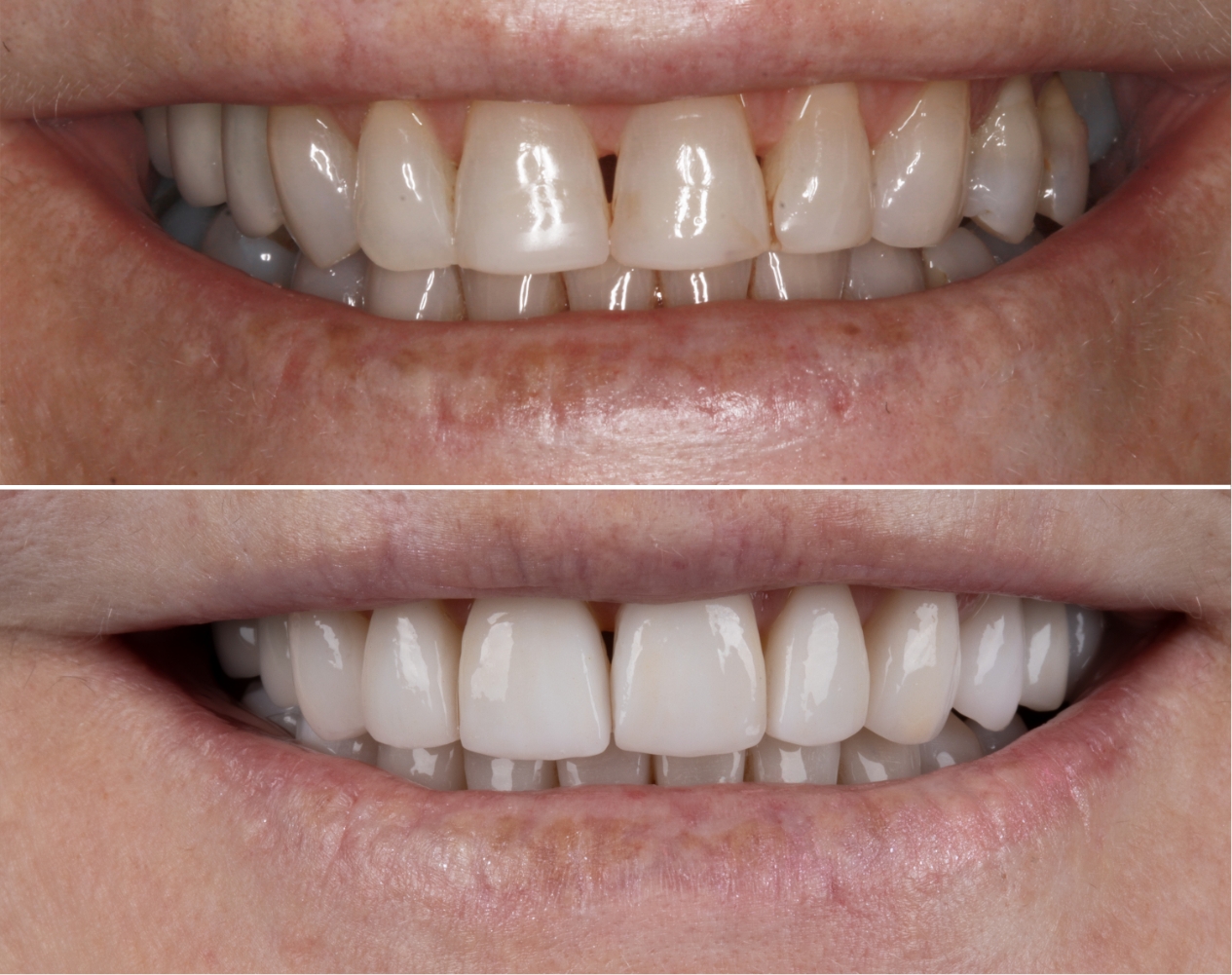 Smile Dentist Clinic in Sydney | Sydney Smile Doctor