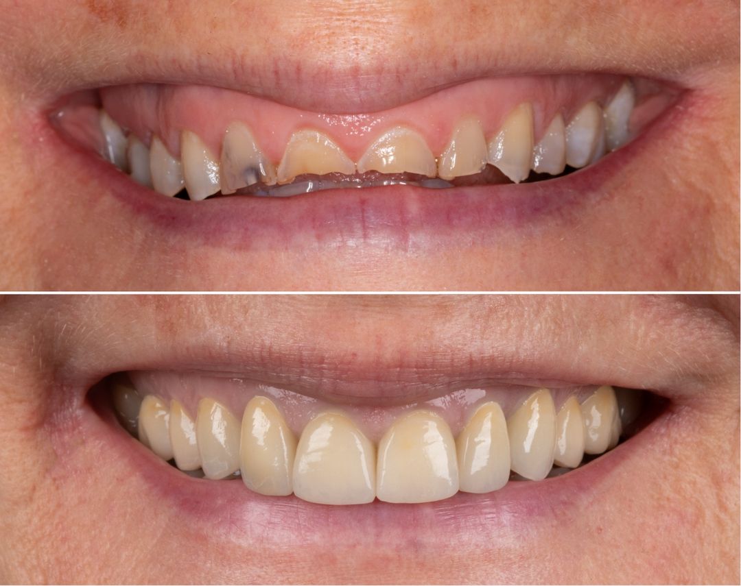 Smile Dentist Clinic in Sydney | Sydney Smile Doctor