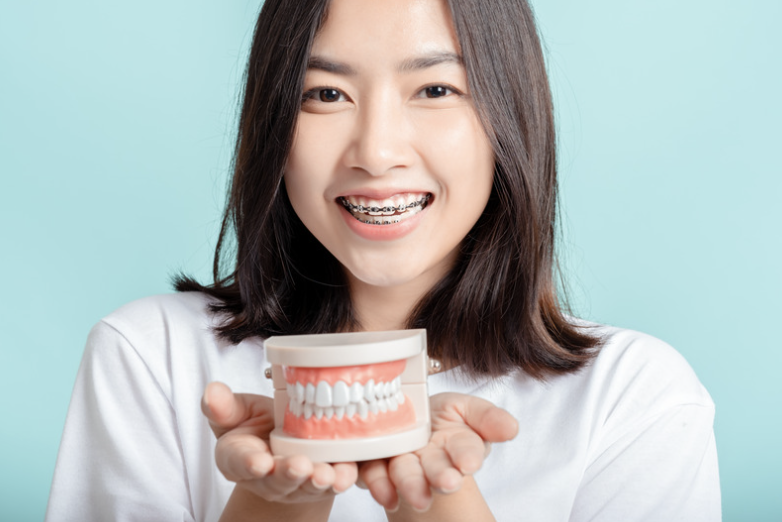 How Much Are Braces in the Philippines in 2023? by By Dr Jeff