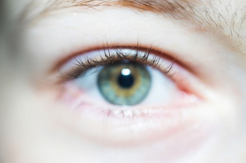 What Is A Refractive Error In The Eyes? | West Boca Eye Center