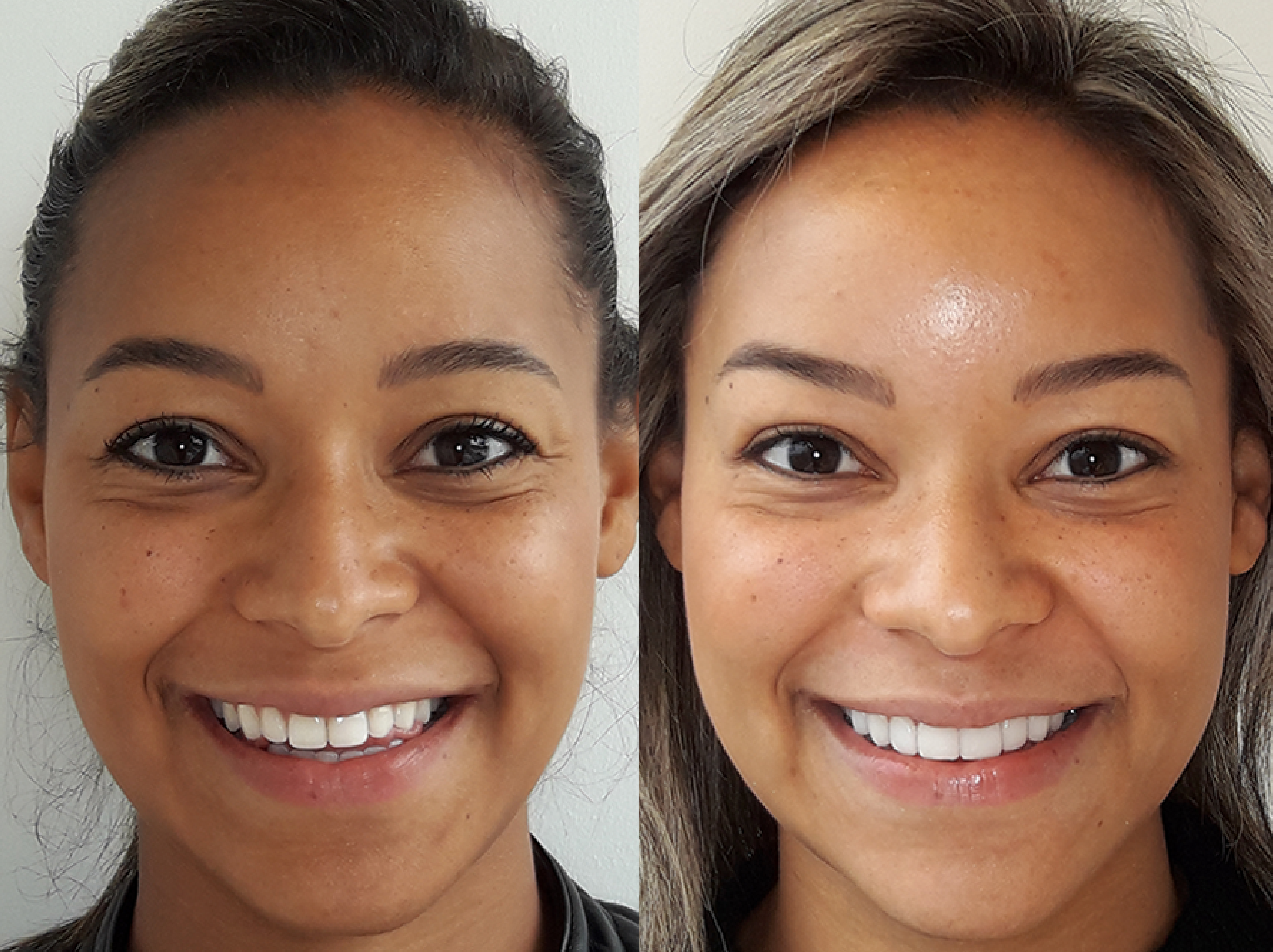 GlamSmile Cosmetic Dentistry