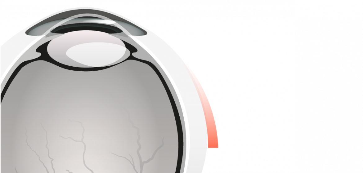 Chirurgia degli Strabismi - STAR 9000 | Brescia