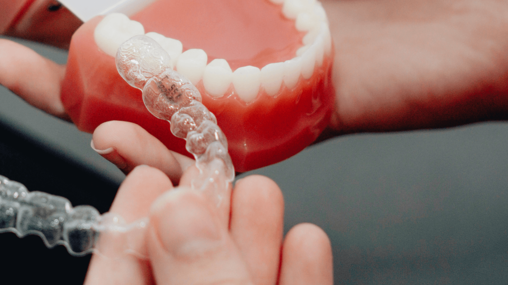 Invisalign® at Wanstead Dental Practice, 1 Nutter Lane