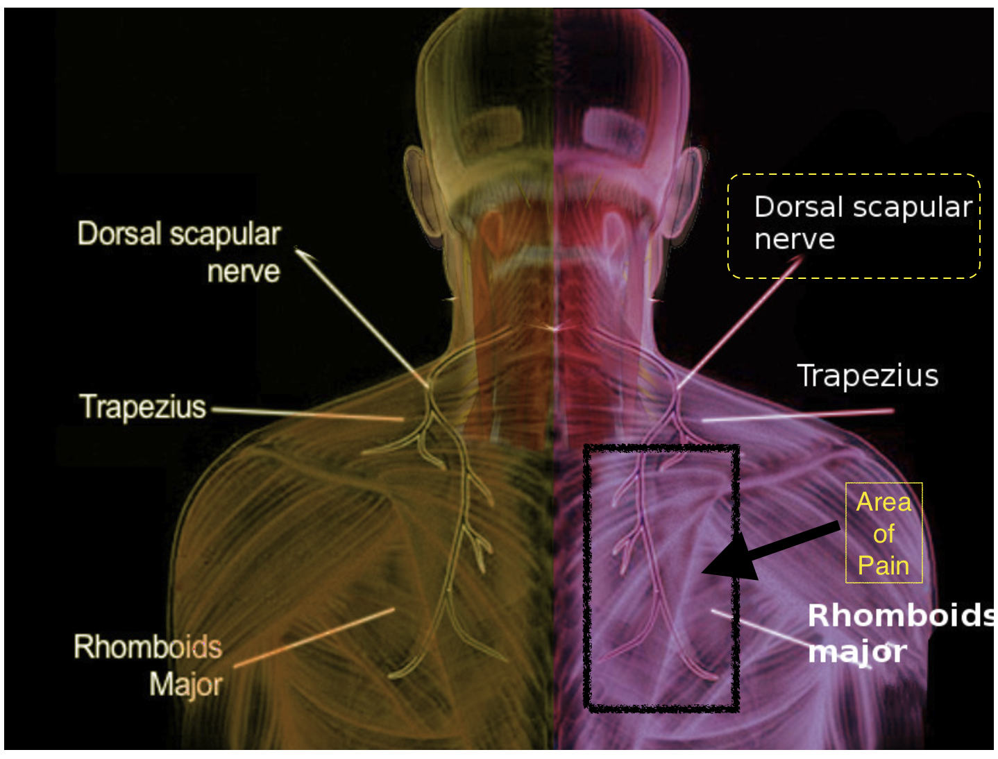 Dorsal scapular nerve | Patient information sheets