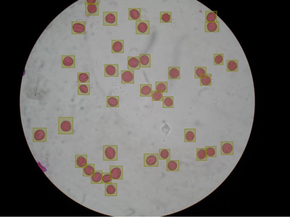 Model-assisted labeling for YOLO