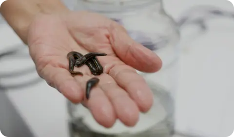 Leech Medicine | California’s Top Leech Therapy Clinic