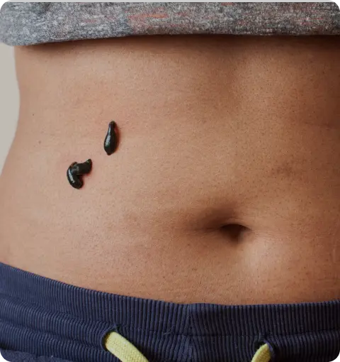 Leech Medicine | California’s Top Leech Therapy Clinic