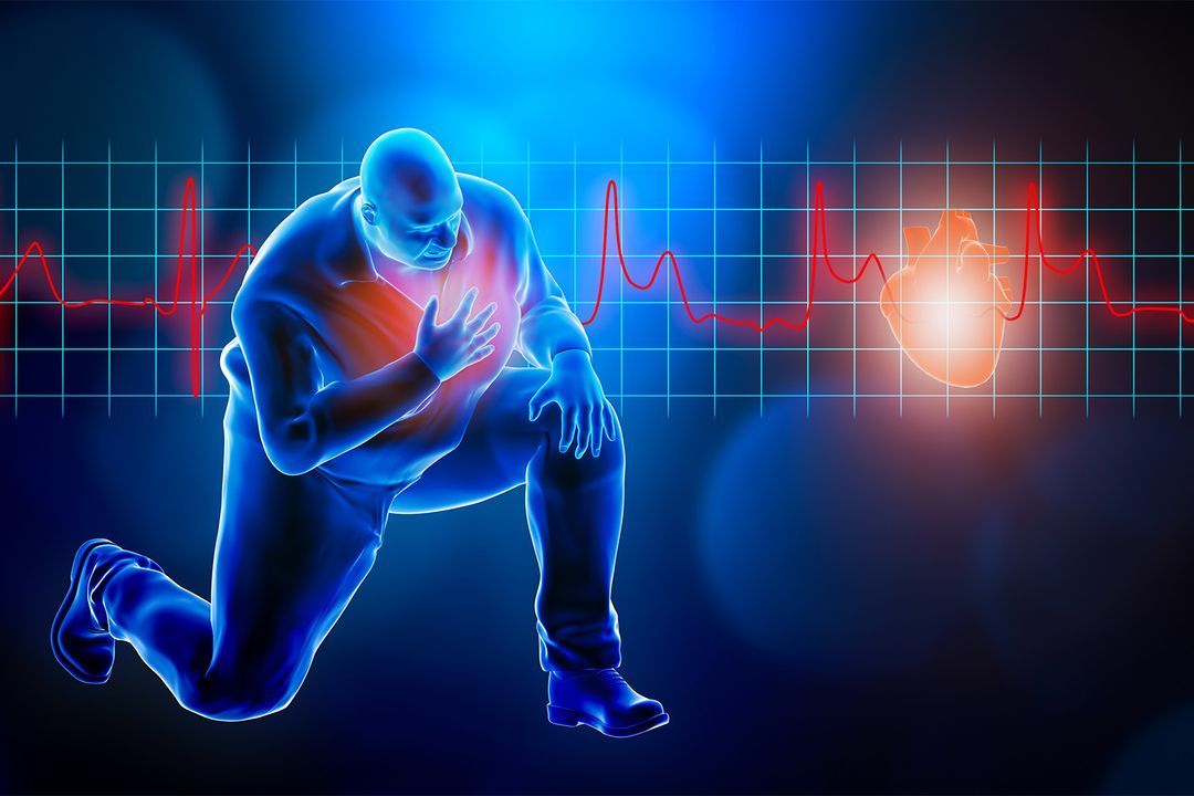 Acute Heart Failure: Types, Symptoms & Treatments | Carda Health