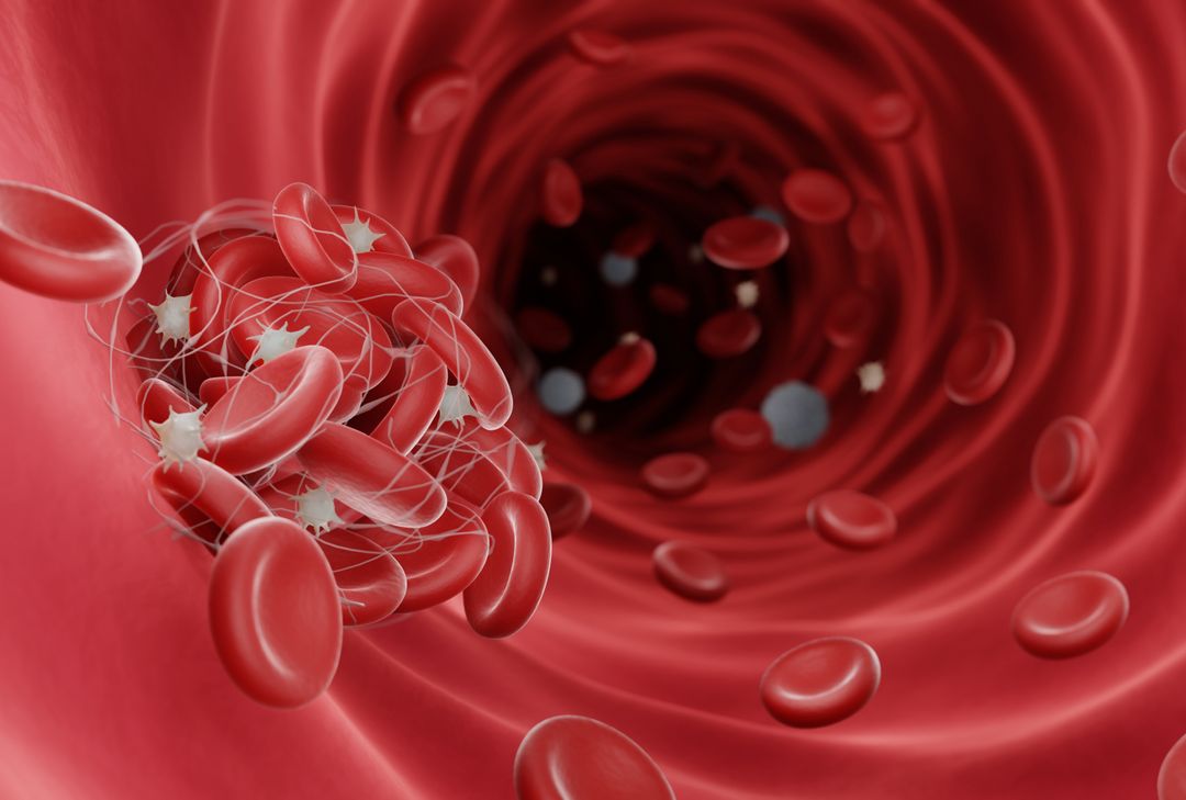 What Are Blood Clotting Disorders? | Carda Health