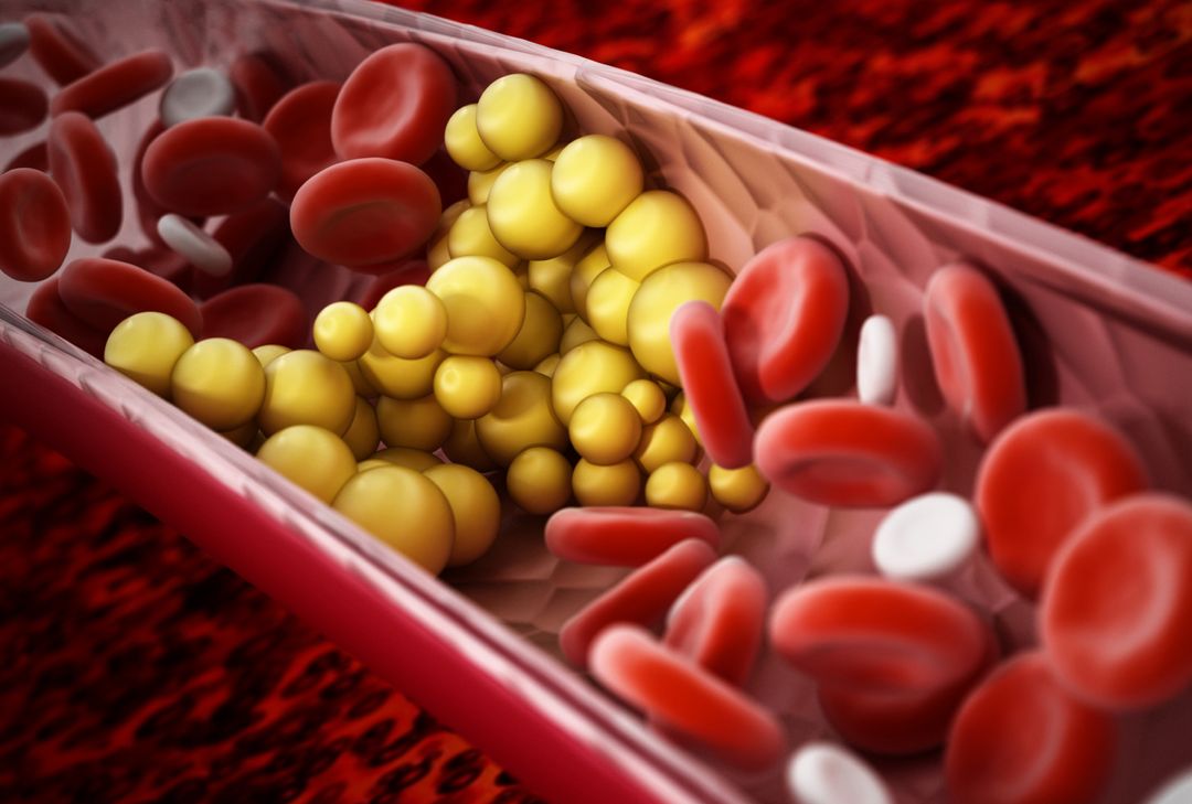 What Foods Cause High Triglycerides? | Carda Health