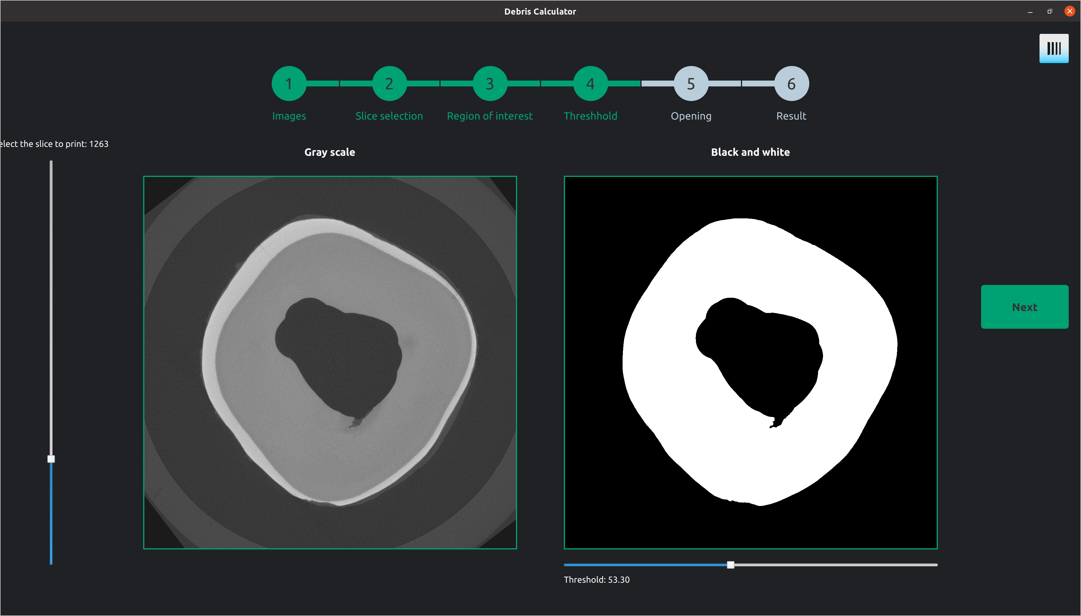 Case study: Medical image analysis tool | Invisto - Your Interface partner