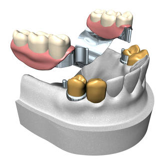 Protetisk behandling