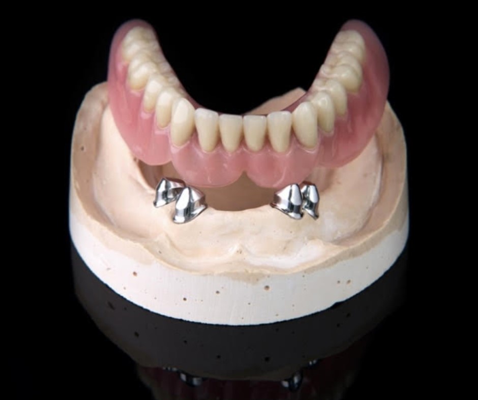 Protetisk behandling