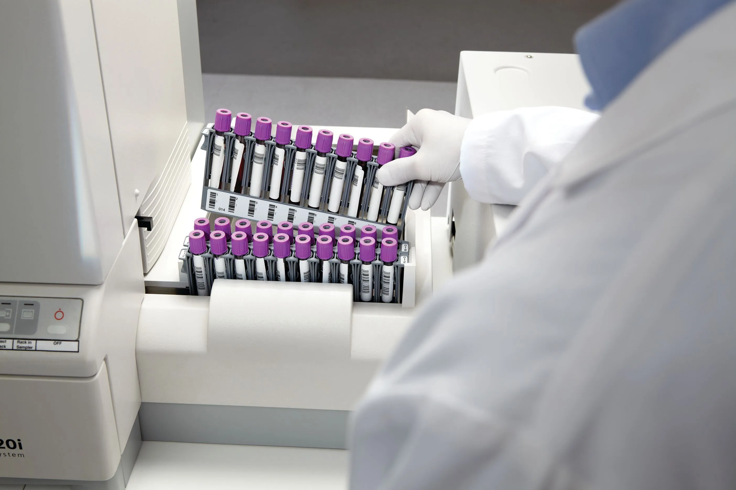 Гематологічна система ADVIA 2120i