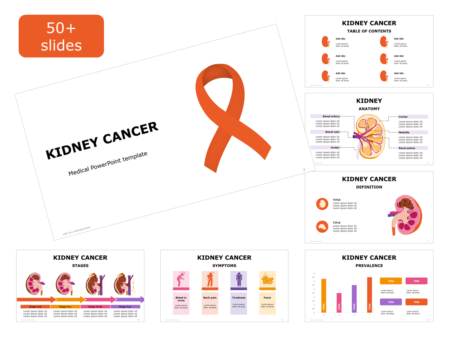 Kidney Cancer PowerPoint Template - RxSlides - The largest online store ...