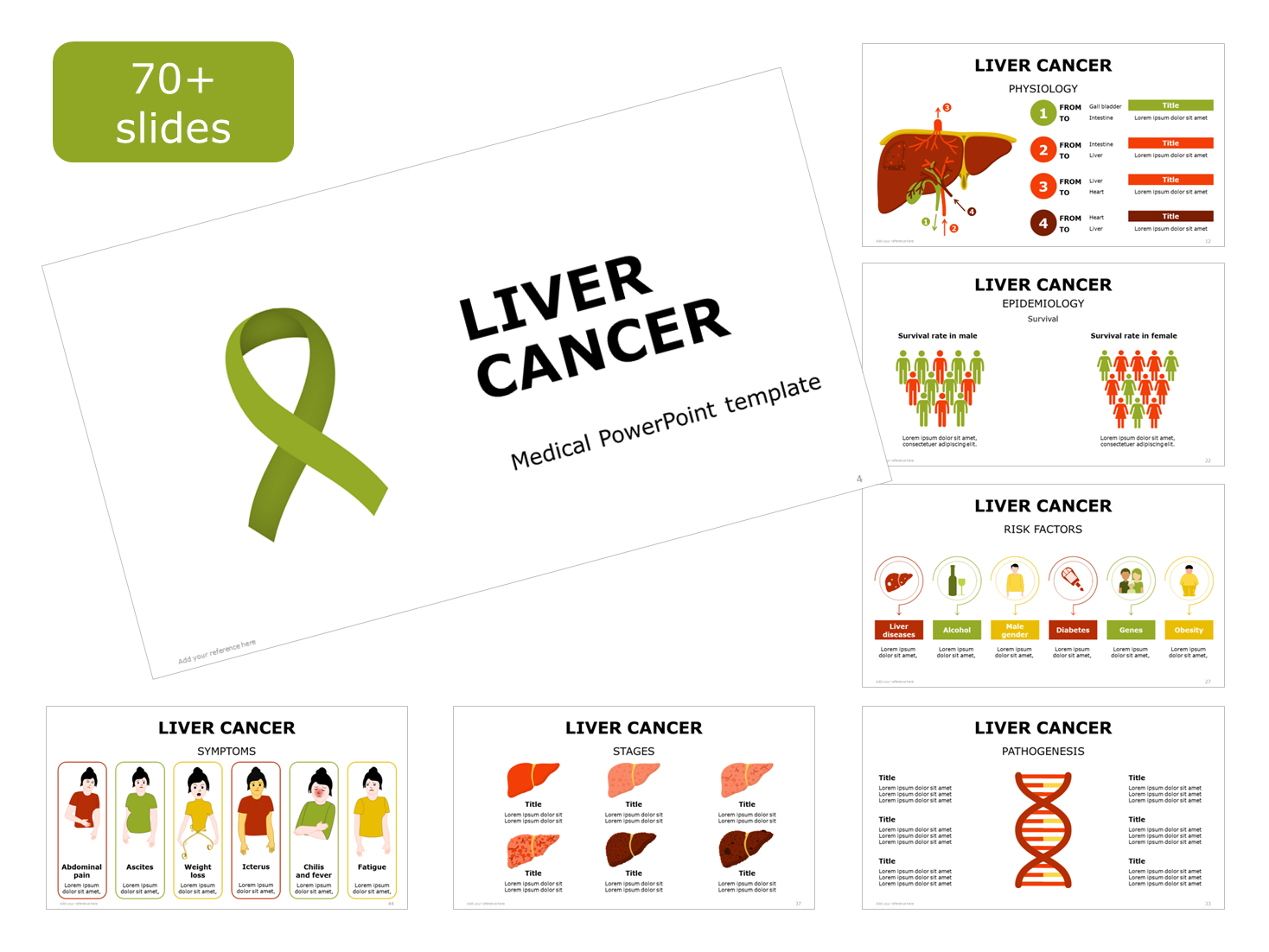 liver Cancer PowerPoint Template - RxSlides - The largest online store ...