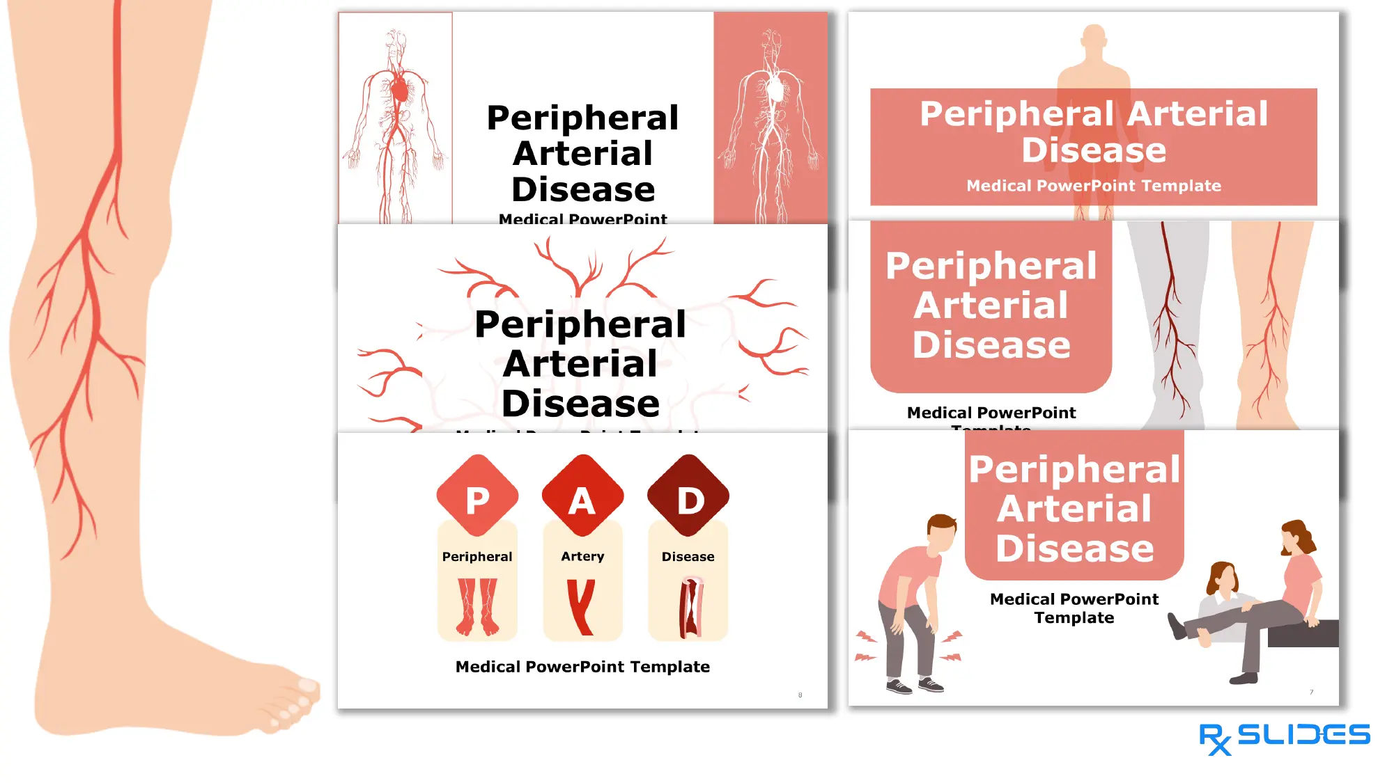 Peripheral Arterial Disease PowerPoint Template - RxSlides - The ...