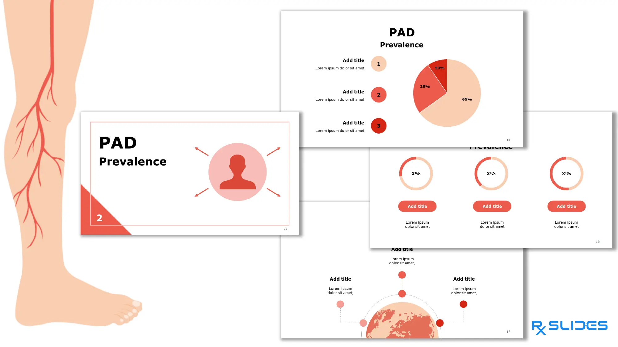 Peripheral Arterial Disease PowerPoint Template - RxSlides - The ...