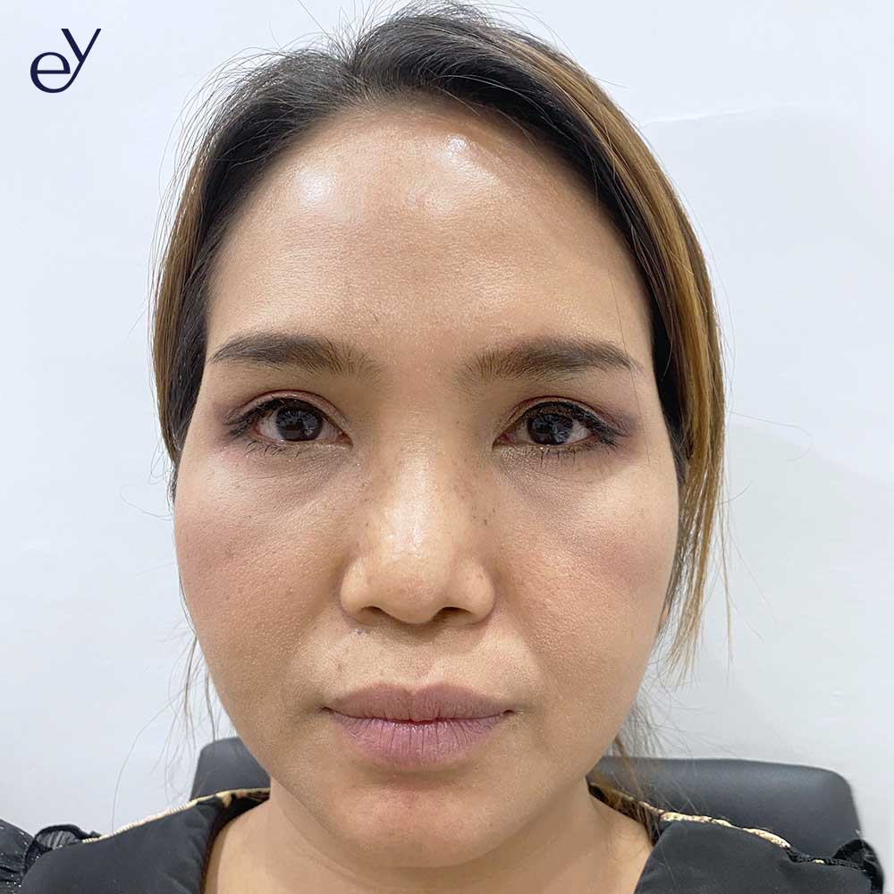 ey skin & wellness | doctors you can trust