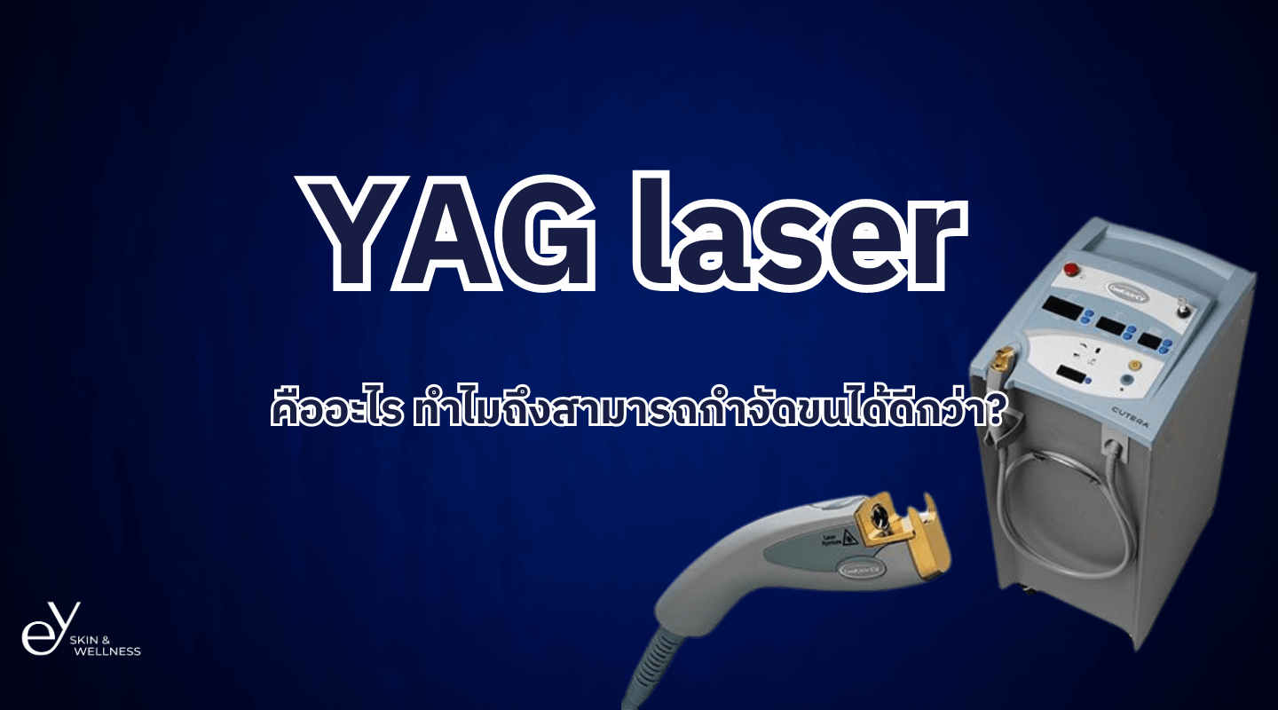YAG Laser คืออะไร ทำไมถึงสามารถกำจัดขนได้ดีกว่า?