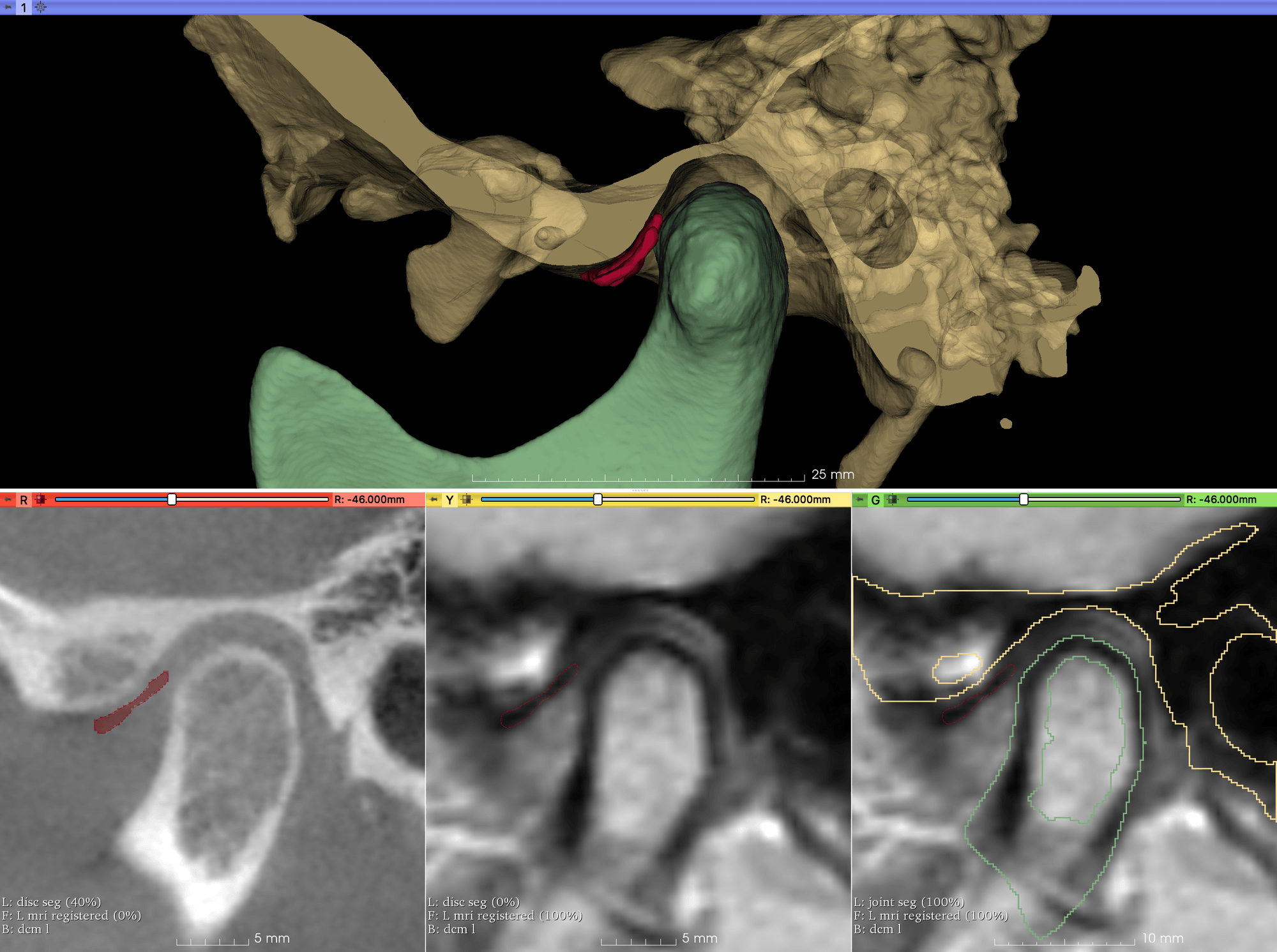 Live Classroom CBCT Imaging Courses | BeamReaders
