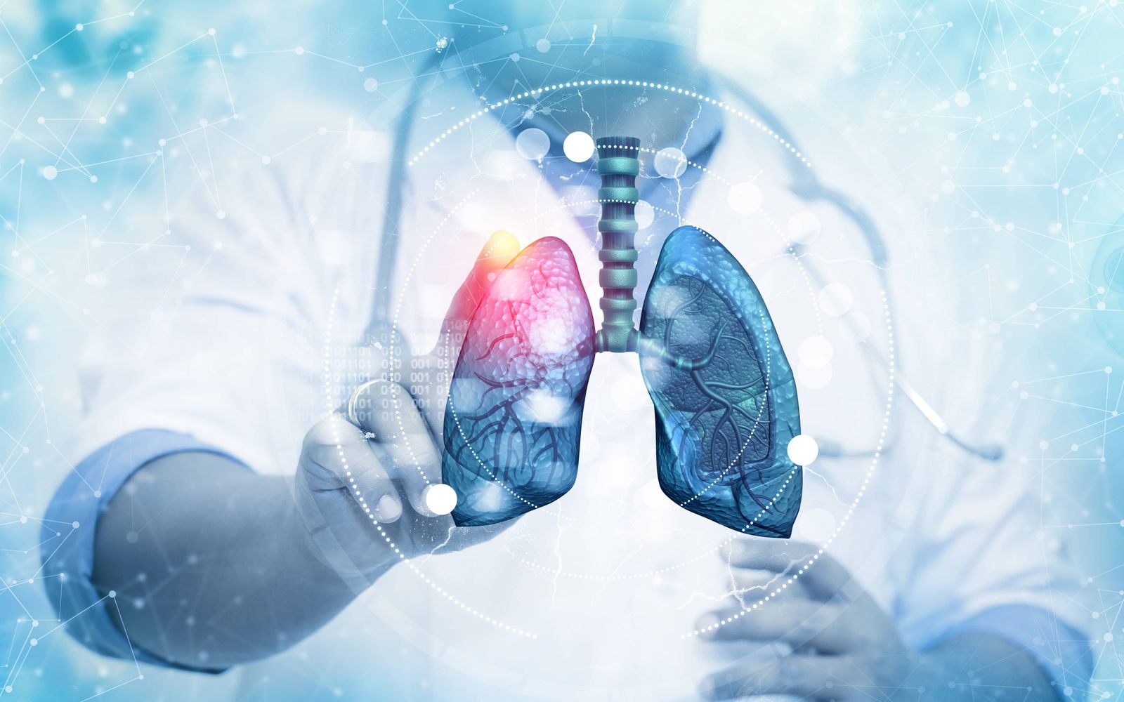 Inhaled chemotherapy for lung cancer