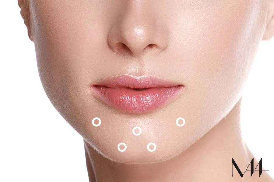 Nonsurgical Aesthetic Treatments for the Face - Med 44 Arcadia Phoenix