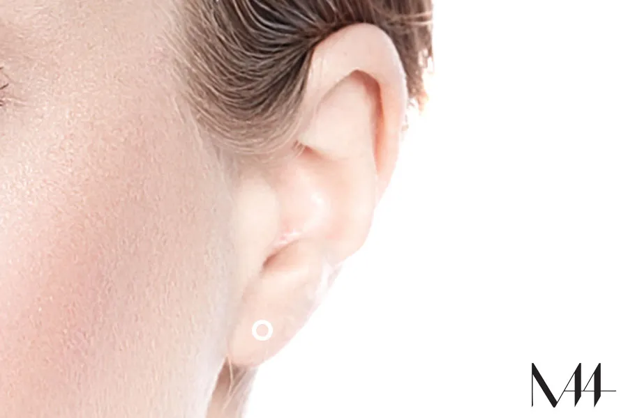 Nonsurgical Aesthetic Treatments for the Face - Med 44 Arcadia Phoenix