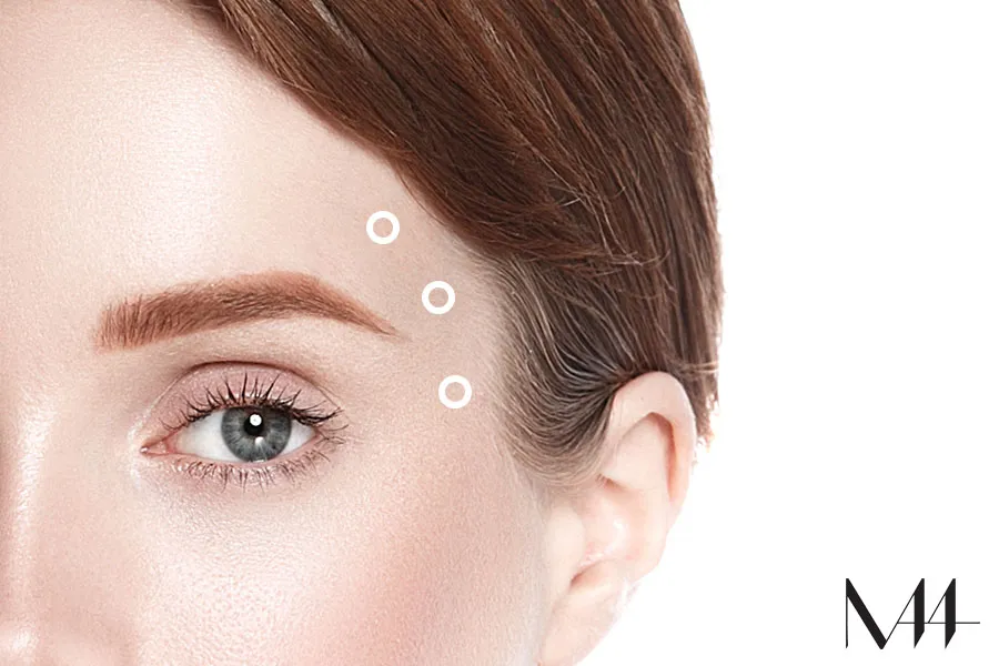 Nonsurgical Aesthetic Treatments for the Face - Med 44 Arcadia Phoenix