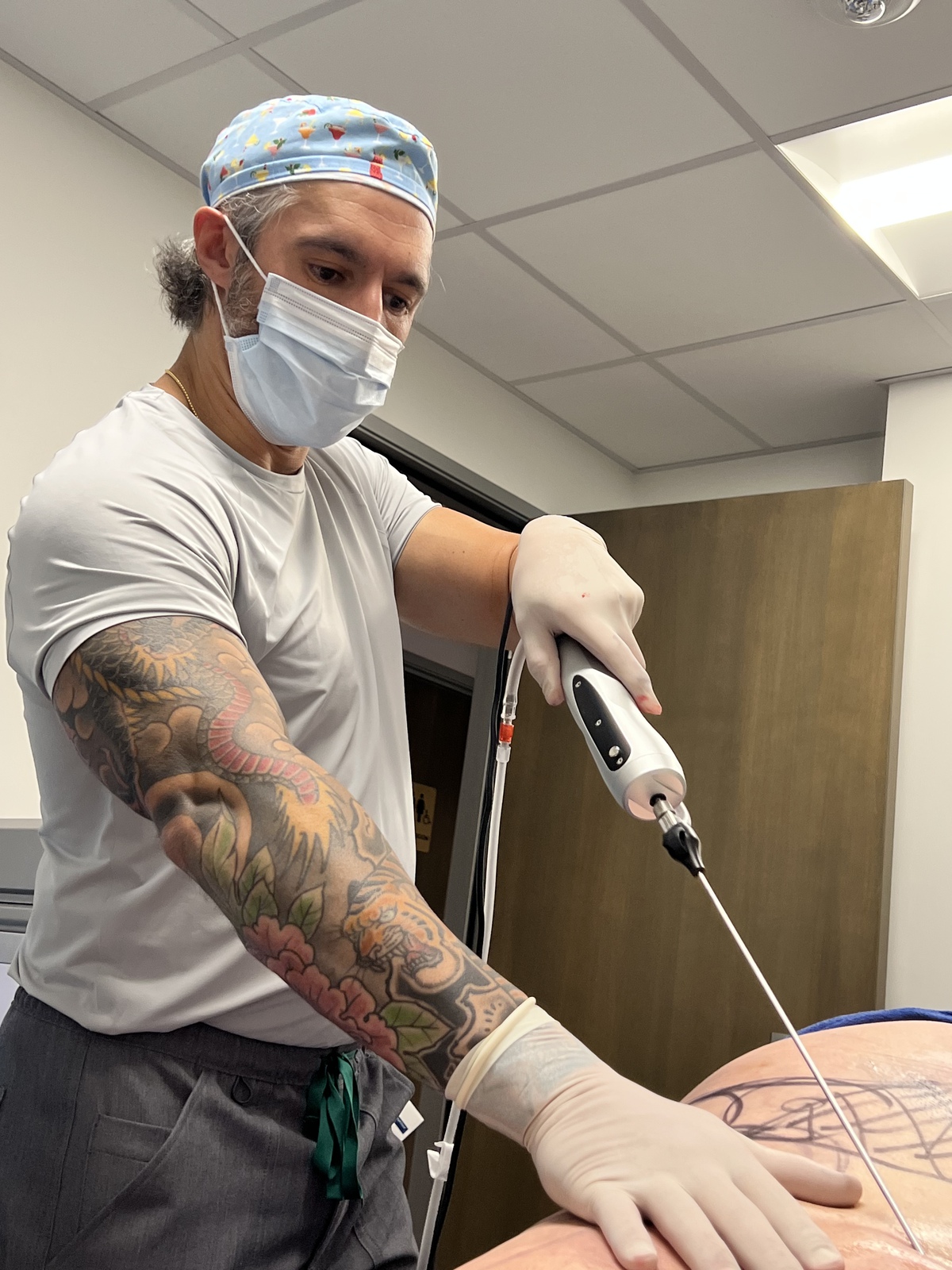 Liposuction in Tempe | True Contour Medical