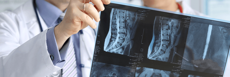 Michigan Spine Surgery Improvement Collaborative | MSSIC