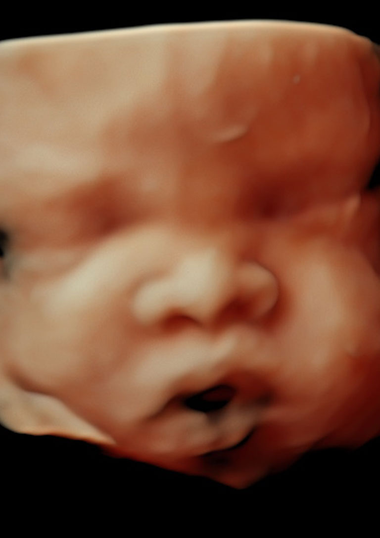 About | 3D Baby Scans Wollongong | Amelie Private