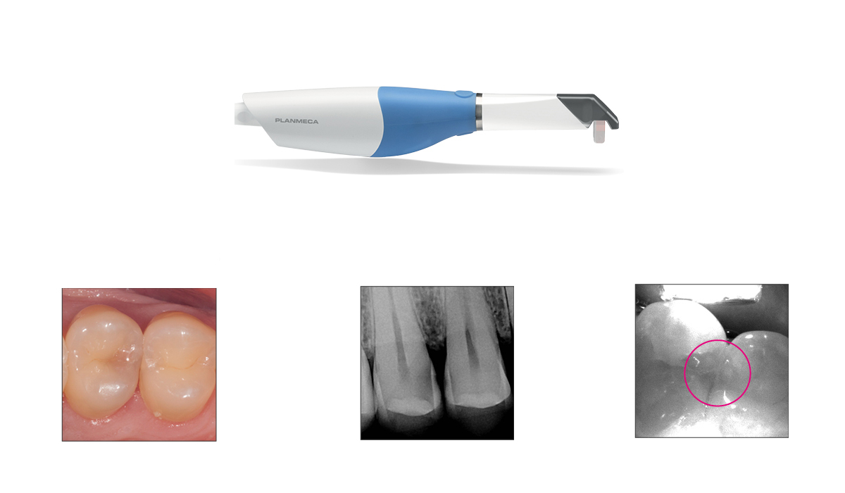 Transforming Dentistry: The Power of Dental 3D Scanning