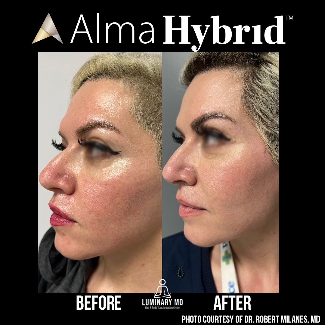 Alma Hybrid Landing Page | Luminary MD